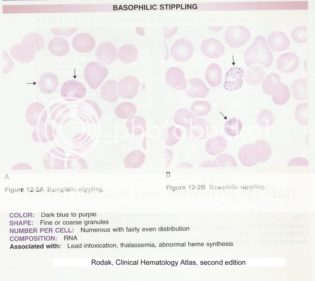 Basophilic Stippling Photo by mccabej3 | Photobucket
