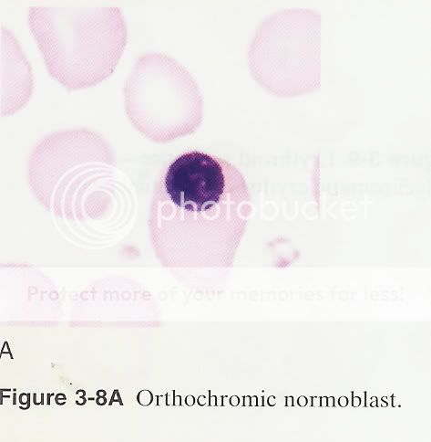 Orthochromic Normoblast Photo by mccabej3 | Photobucket